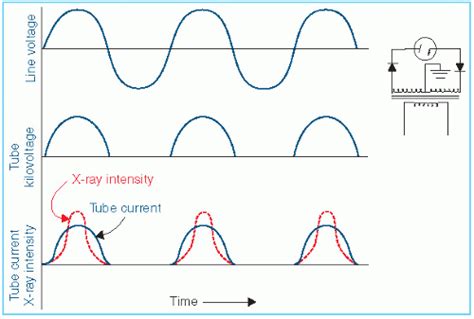 Production Of X Rays Radiology Key