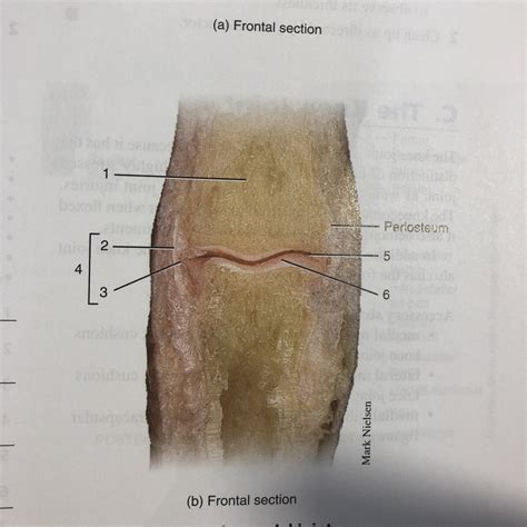 Typical Synovial Joint Diagram Quizlet