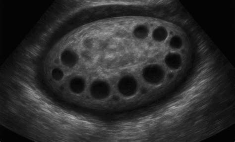 Struggling With Irregular Periods Discover The Best Time For An
