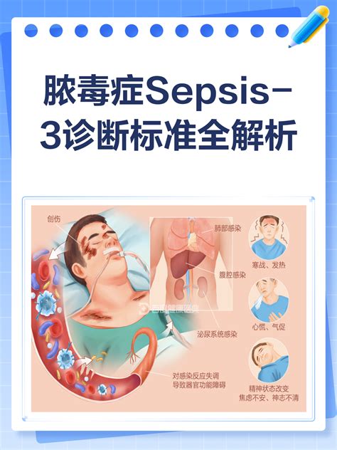 脓毒症sepsis 3诊断标准，一文读懂！