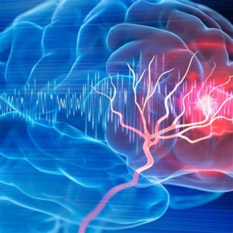 Stroke Prediction Dataset Kaggle