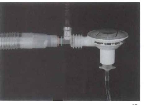 Figure 1 From Efficacy Of The Fef Colorimetric End Tidal Carbon Dioxide