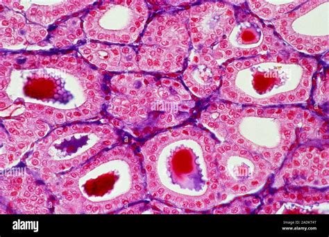 Light Micrograph Of The Human Thyroid Gland Showing The Functional Units Of Thyroid Follicles