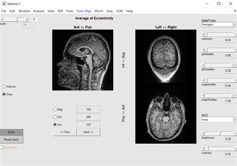 GitHub Marco Create Retinotopy Pipeline To Map Visual Input From The Retina To Neurons Using