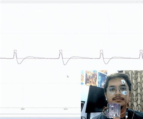 Eye Blink Detection By Recording Eog Using Bioamp Exg Pill 8 Steps