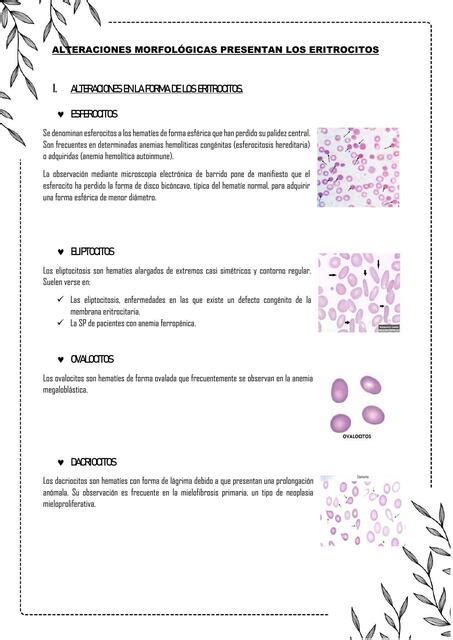 Alteraciones MorfolÓgicas Presentan Los Eritrocito Melany Katherine