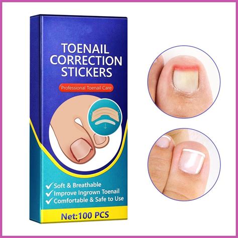 Toenail Patch Ingrown Toenail Corrector Strips 100pcs Safe Ingrown Toe Nail Corrector Strips For