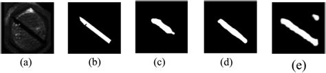 The Marker Line Regions Predicted By The Existing Saliency Detection