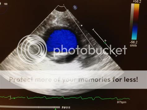 Let S Do Some Echo Babe Doctor Network