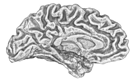 Deepms Deep Learning For The Detection Of Disease Activity In Multiple Sclerosis
