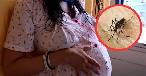 ¿embarazadas En Peligro Por El Dengue Picadura De Mosquito Podría Transmitir Enfermedad Al Feto