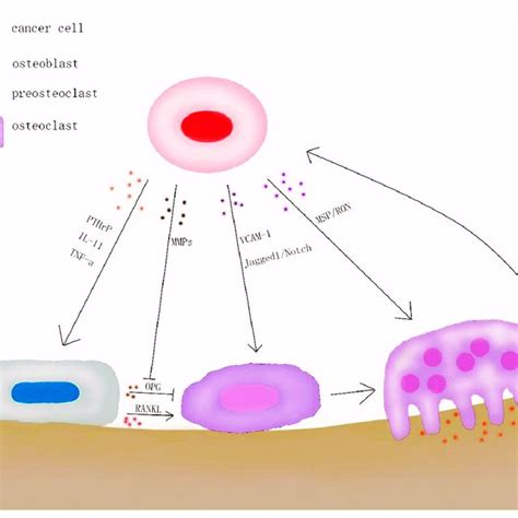 Comparison Of Bone Tumor Microenvironment In Metastasis Versus Sarcoma