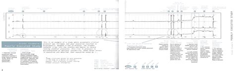 Normal Uroflow Chart Keski
