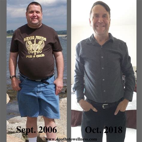 The Importance Of Before And After Photos On Your Weight Loss Journey