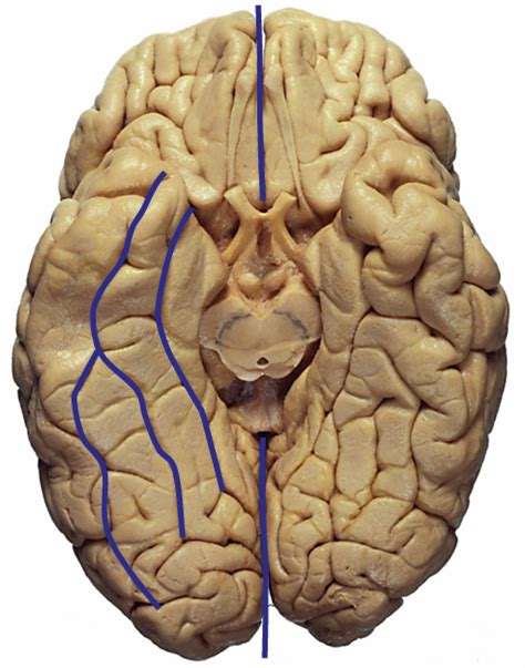 Cerebral Cortex Ventral View Diagram Quizlet Cerebral Cortex Ventral View Diagram Quizlet