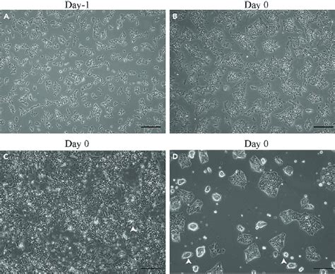 Morphology Of Ipsc Cells Transition To Rim Phase Day 2 To Day 1 A And