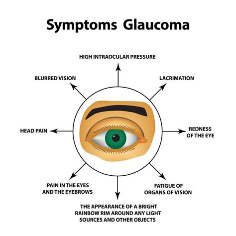 What Is Glaucoma Georgia Eye Clinic