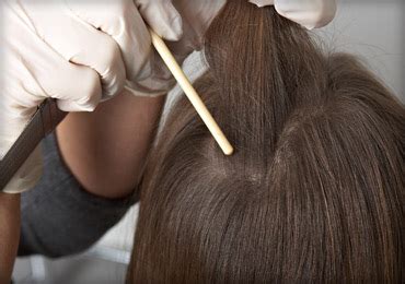 Examination For Head Lice Malta Union Of Teachers