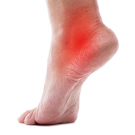 Ankle Sprain Physio Fixes