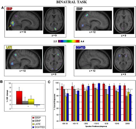 Figure 1 From Differential Occipital Responses In Early And Late Blind Individuals During A