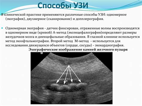 УЗИ ультразвуковое исследование презентация онлайн