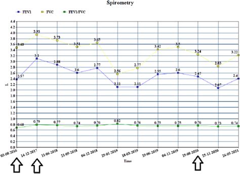 Spirometry From Referral To End Of Follow Data For Fev1 And Fvc Are Download Scientific Spirometry From Referral To End Of Follow Data For Fev1 And Fvc Are Download Scientific