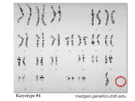 PPT Chapter And Complex Inheritance And Karyotypes PowerPoint Presentation ID