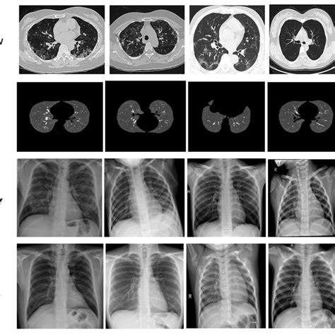 Sample Datasets Where W Sample Training Set CT Scan Images X Sample Download Scientific