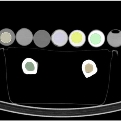 Experimental Layout And Bone Segmentation To Quantify The Volume Download Scientific Diagram