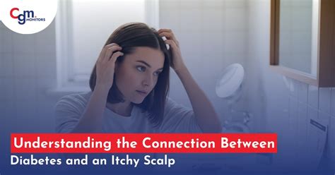 The Connection Between Diabetes And An Itchy Scalp