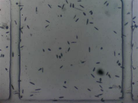 Euglena Dataset And Pre Trained Model By Shrimp Dectection