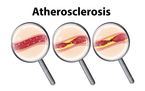 Naturwissenschaftlicher Unterricht Menschliche Anatomie Und