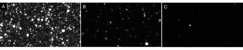 Nanoparticle Tracking Analysis For The Quantification And Size