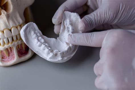 Treatment Information Snodgrass King Orthodontics