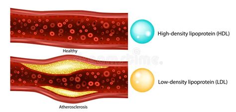 cholesterol low density lipoprotein ldl and high density lipoprotein