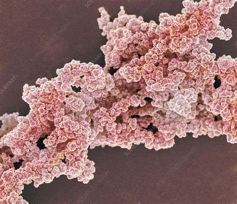 Yeast Extracellular Matrix Sem Stock Image C026 9287 Science Photo Library