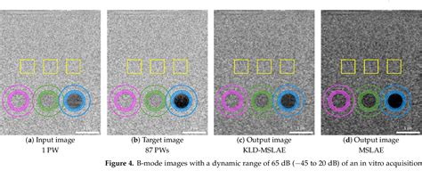Figure 4 From A Kl Divergence Based Loss For In Vivo Ultrafast Ultrasound Image Enhancement With