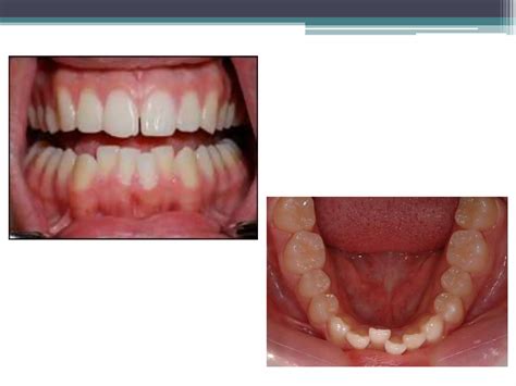 Self Correcting Anomalies Pptx