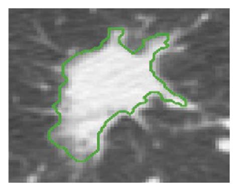 Generating Ground Truth Through The Annotations Of Ct Slice A