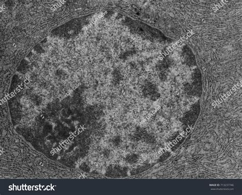 Transmission Electron Microscope