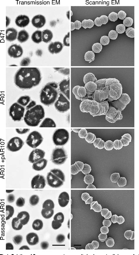 figure 1 from streptococcus pyogenes sortase mutants are highly