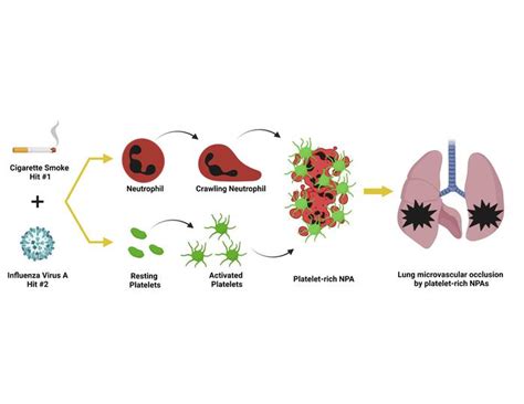 Jci Insight Lung Microvascular Occlusion By Platelet Rich Neutrophil Platelet Aggregates