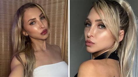 MRI Scan Captures Couple Having Sex In Viral TikTok News Com Au Australias Leading News