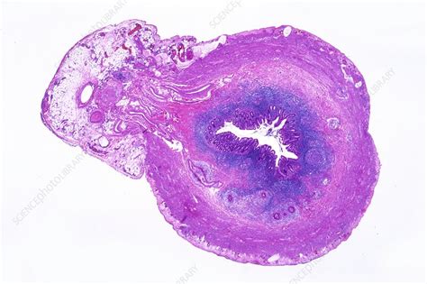 Human Appendix Light Micrograph Stock Image C028 6604 Science Photo Library