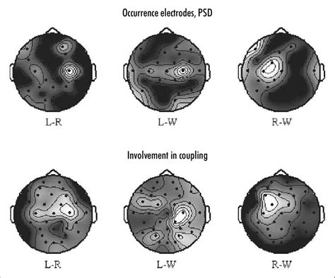 Positions Of The Electrodes Used For EEG Recording Download Scientific Diagram