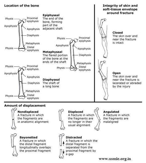 For Coding Fractures Medical School Essentials Nurse Study Notes