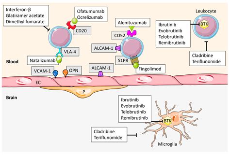 Multiple Sclerosis