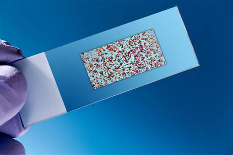 Dna Microarrays And Multidrug Resistant Bacteria
