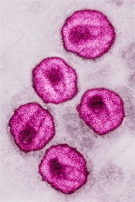 Hiv Particle Tem Stock Image C035 4465 Science Photo Library
