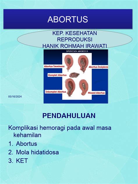 Panduan Lengkap Tentang Abortus Pdf